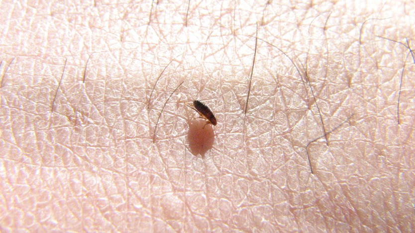 Flea Bite Turns Deadly: Texas Man's Health Crisis